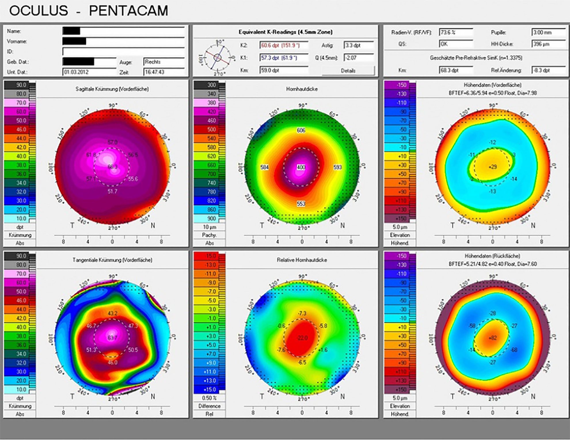 Vorderabschnitts-Tomographie (Pentacam) - augencentrum-dresden.de